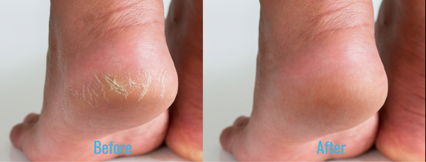 Derm 42 Skin Care w/ Free Pumice Stone and Brush – Free Life Labs